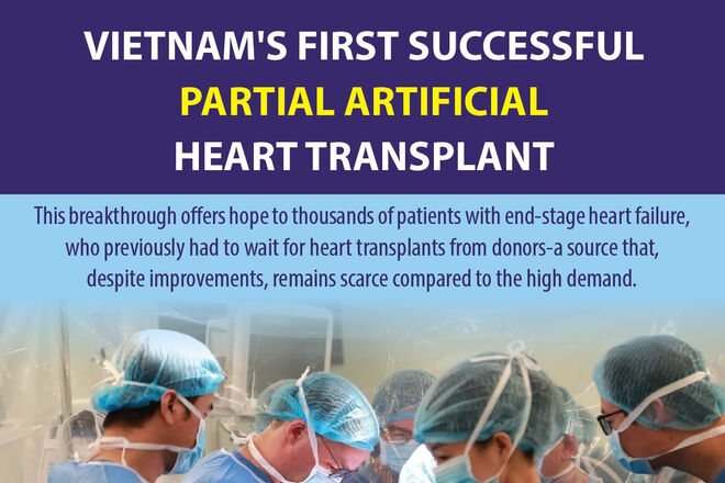 Vietnam's first successful partial artificial heart transplant
